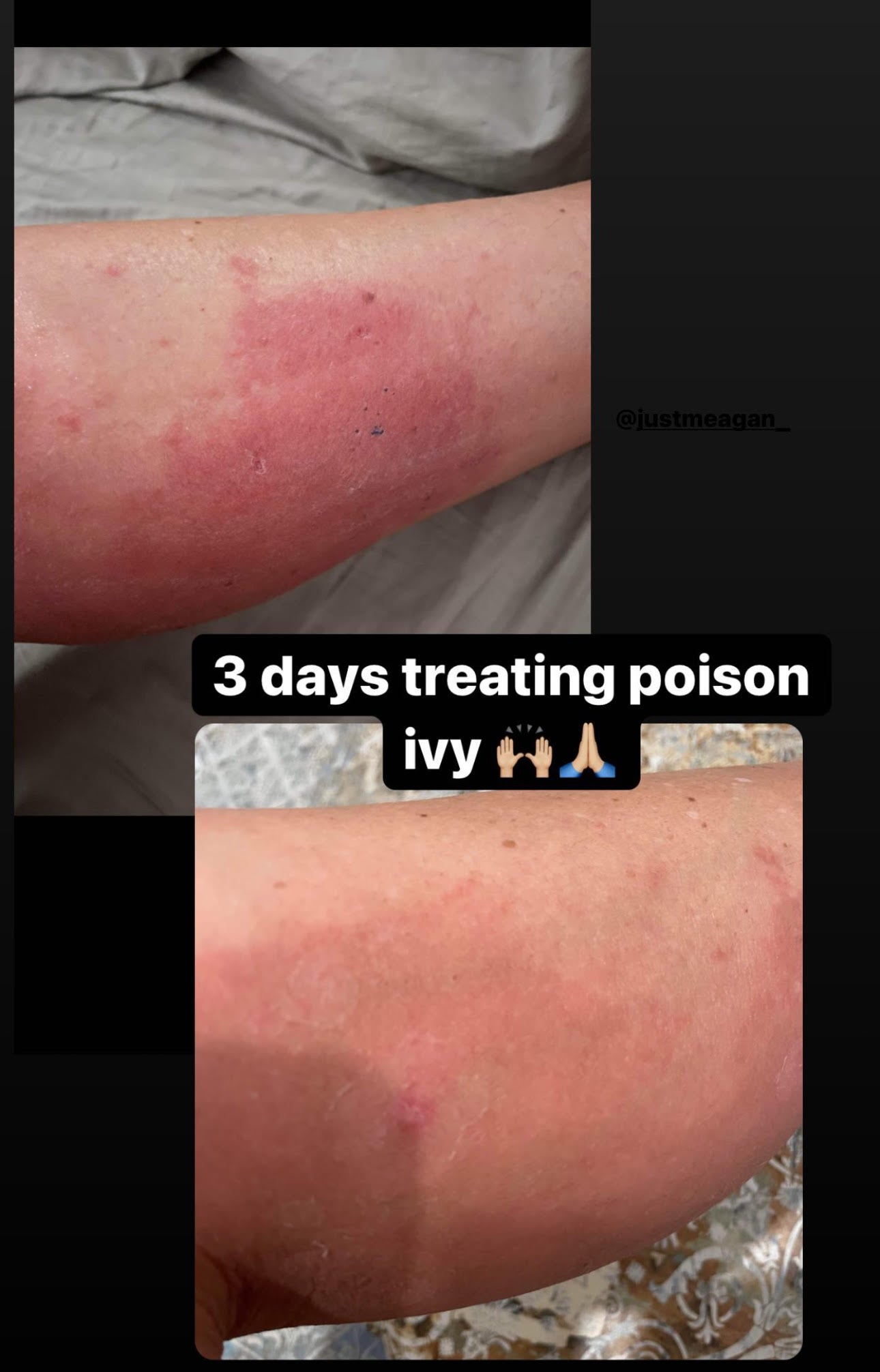 Before & After – tallowandhoney