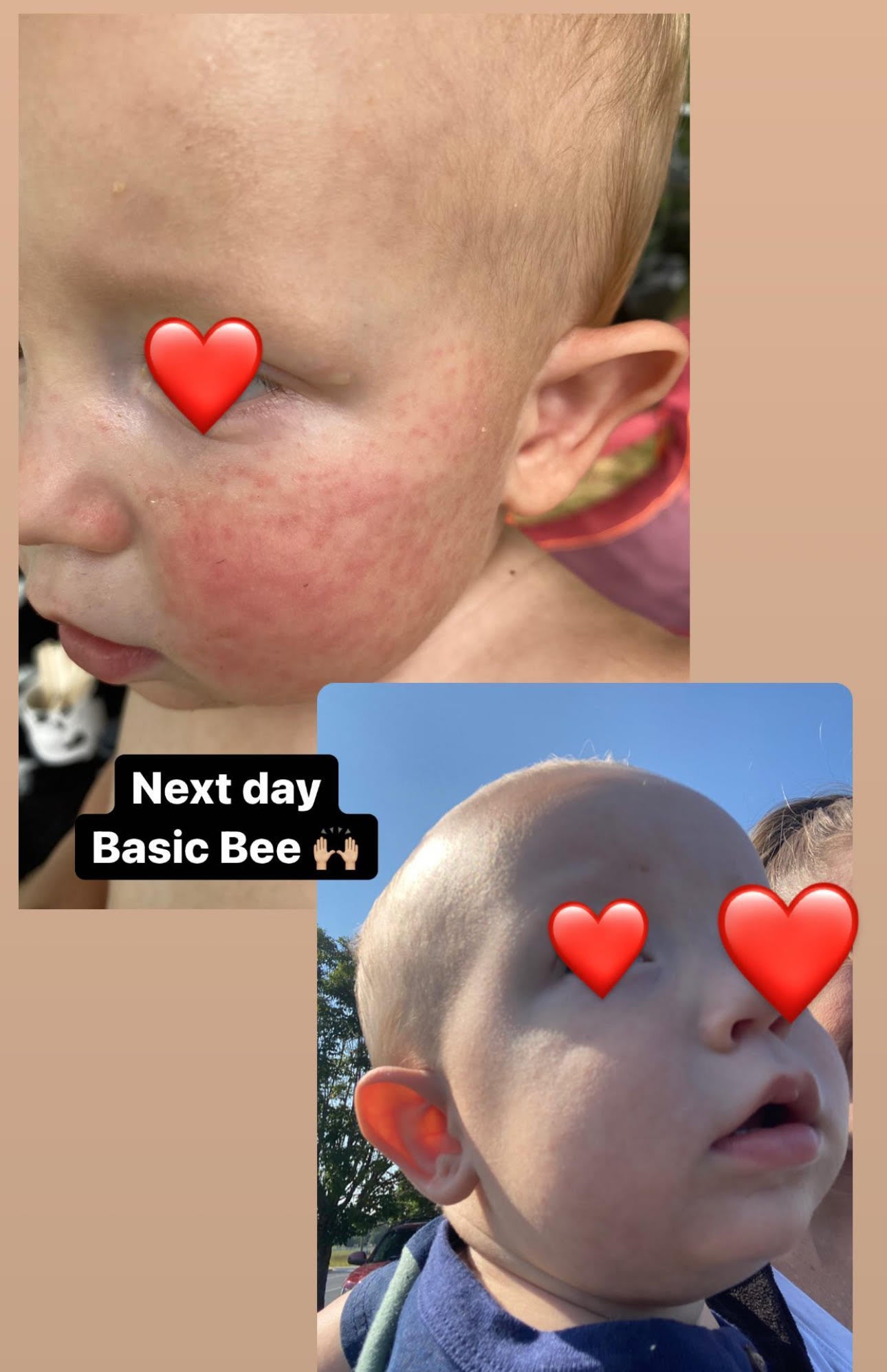 Before & After – tallowandhoney